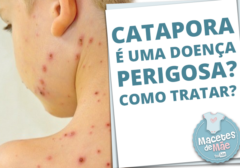 Catapora ou Varicela: saiba tudo sobre a doença | Macetes de Mãe